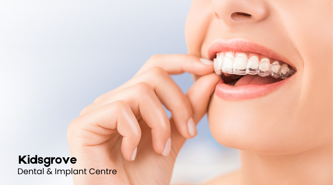 Invisalign vs. Traditional Braces: What’s Best For You?
