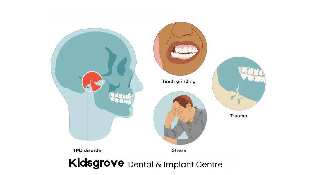 TMJ Pain Explanation: Symptoms, Causes, and Solutions - Kidsgrove ...